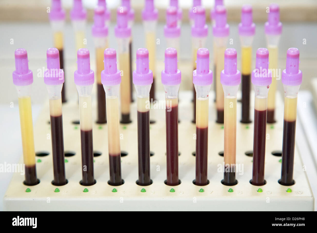Essen, Allemagne, la mesure de la vitesse de sédimentation des ...