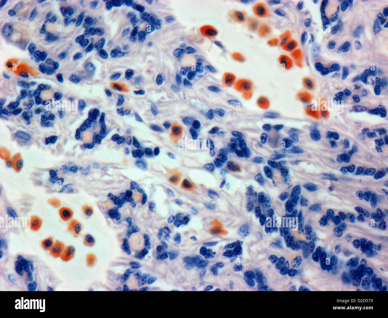 Light micrograph red blood cells Banque de photographies et d’images à ...