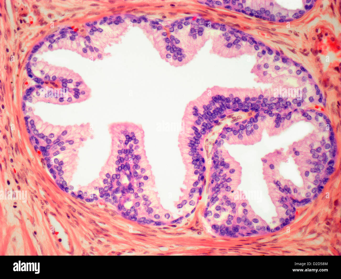 Maladie de basedow Banque de photographies et d’images à haute ...