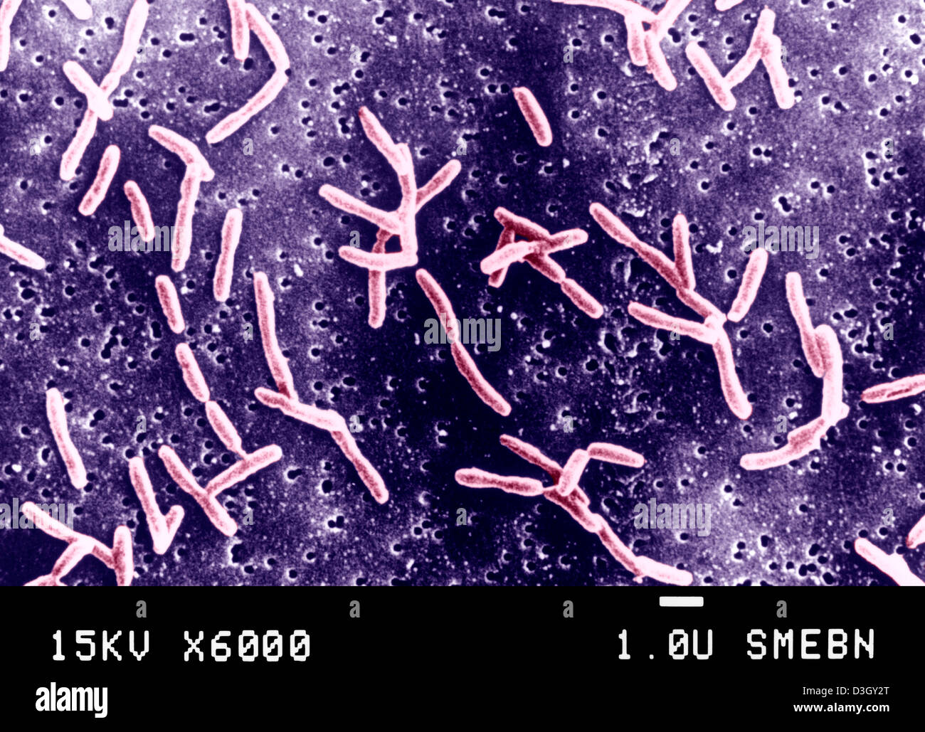 Campylobacter microscope Banque de photographies et d’images à haute ...
