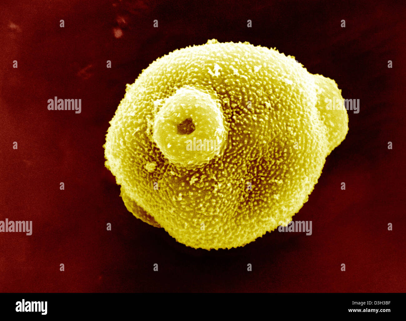 Electron microscope pollen bouleau Banque de photographies et d’images ...