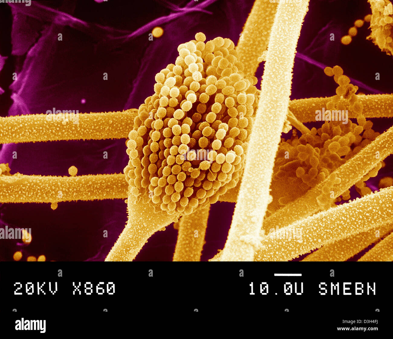 Aspergillus flavus Banque de photographies et d’images à haute ...