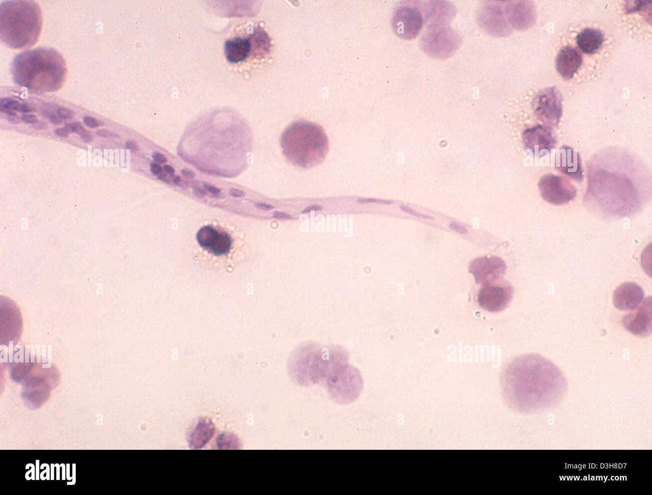 Loa loa ver parasite Banque de photographies et d’images à haute ...