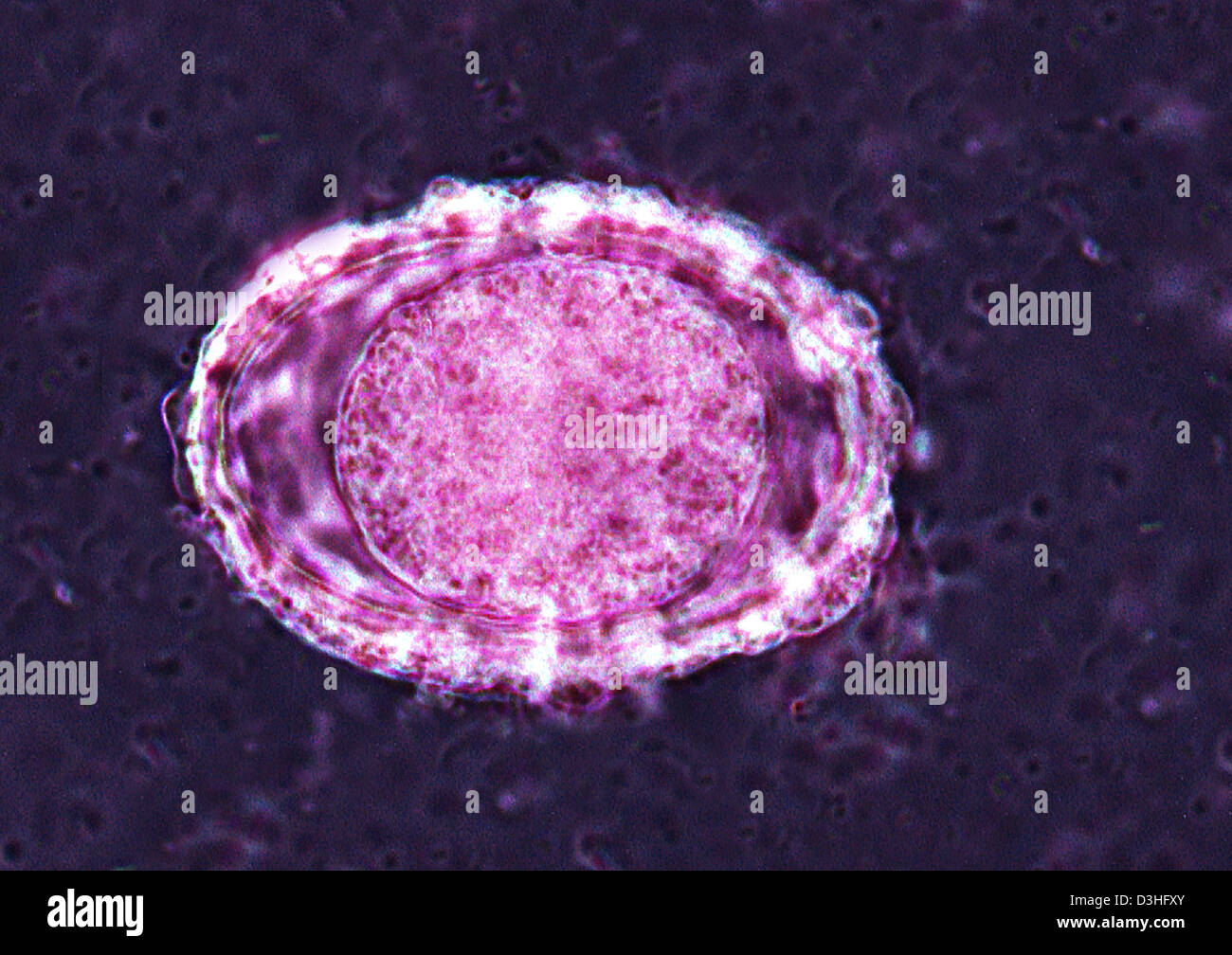 Roundworm microscope Banque de photographies et d’images à haute ...