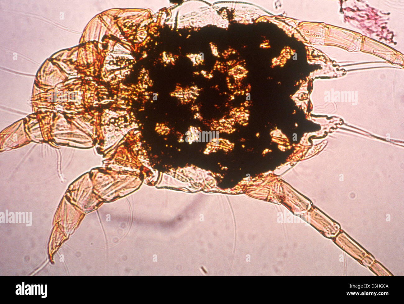 Acariens de la gale Banque de photographies et d’images à haute ...