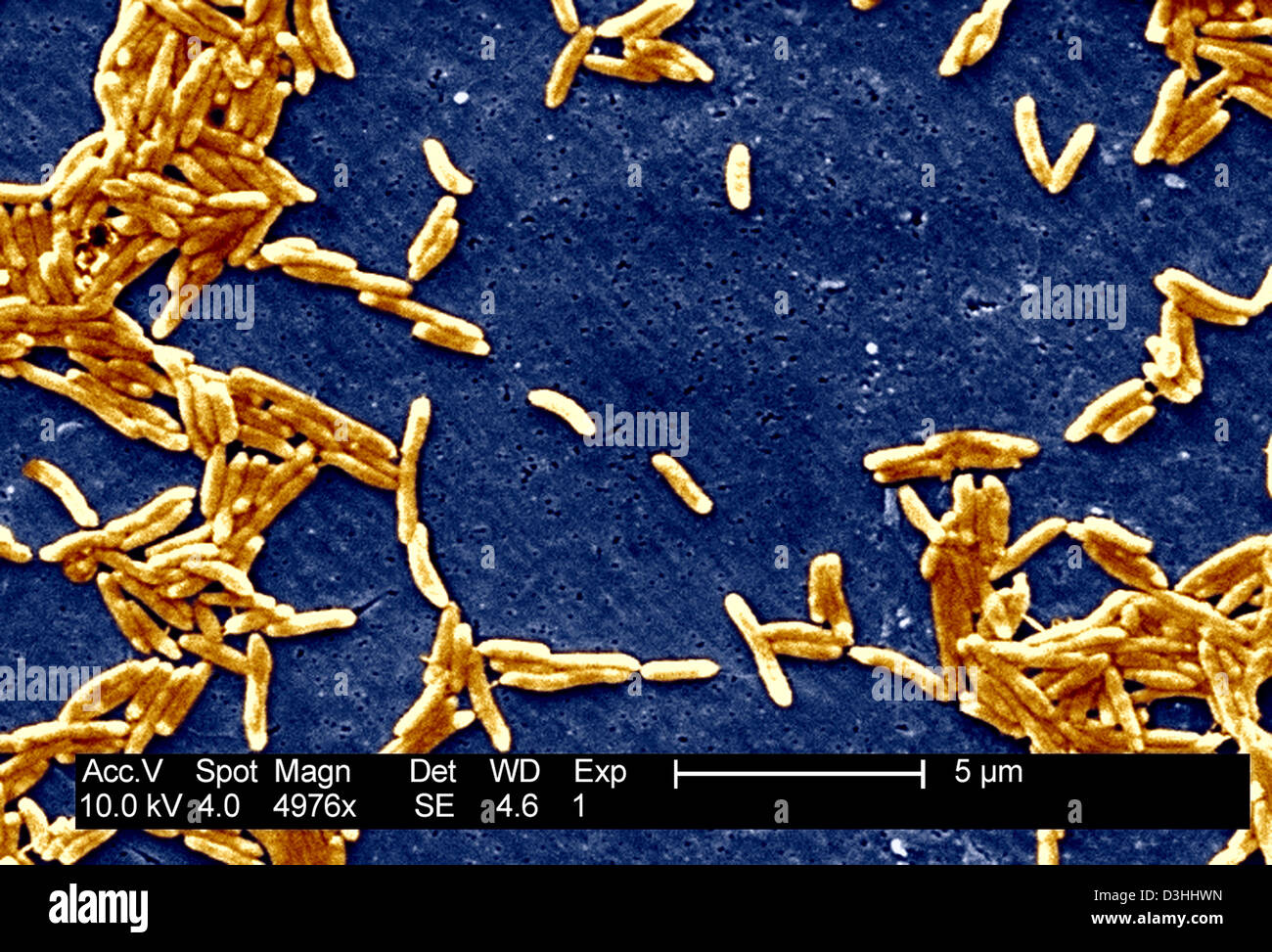 Campylobacter microscope Banque de photographies et d’images à haute ...