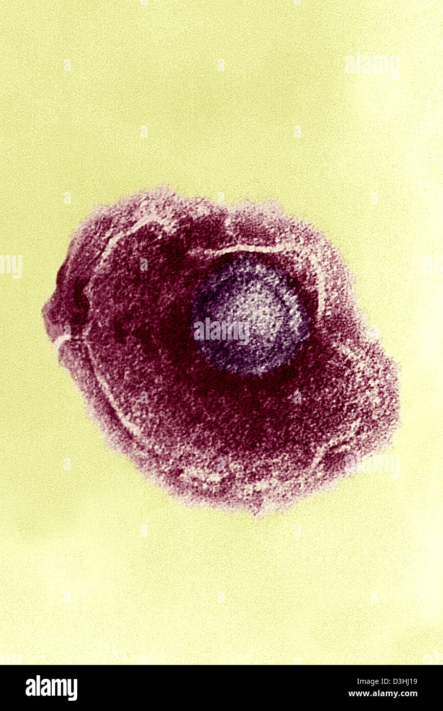 Varicella zoster micrograph Banque de photographies et d’images à haute ...