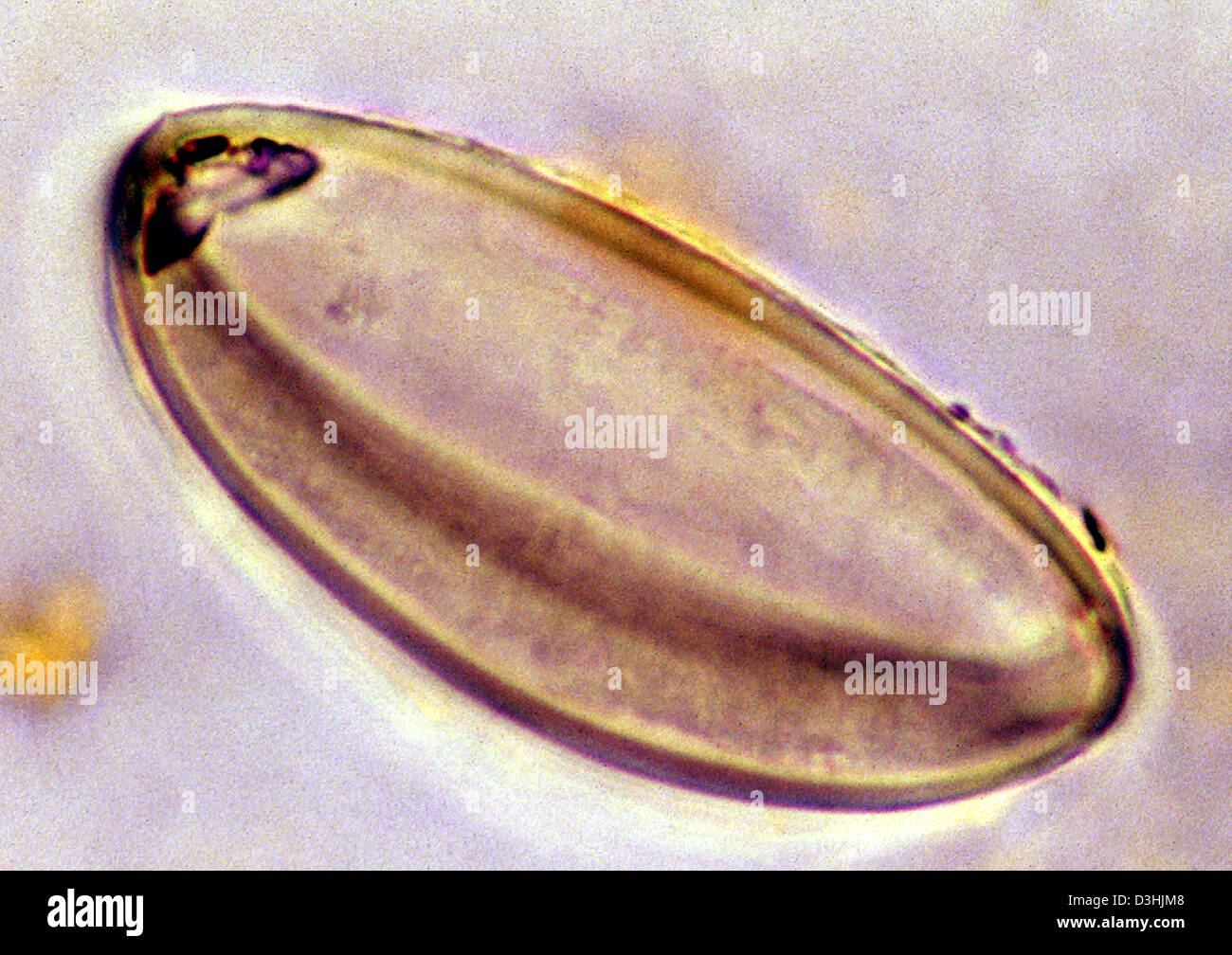 Enterobius vermicularis Banque de photographies et d’images à haute ...