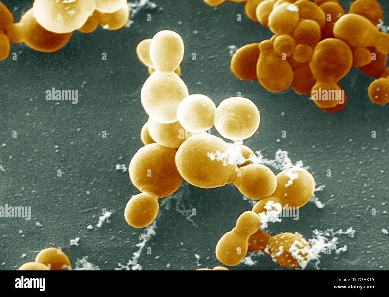 Malassezia Furfur Banque d'image et photos - Alamy