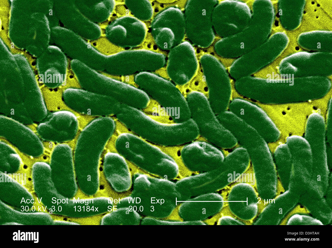 Vibrion sp Banque de photographies et d’images à haute résolution - Alamy