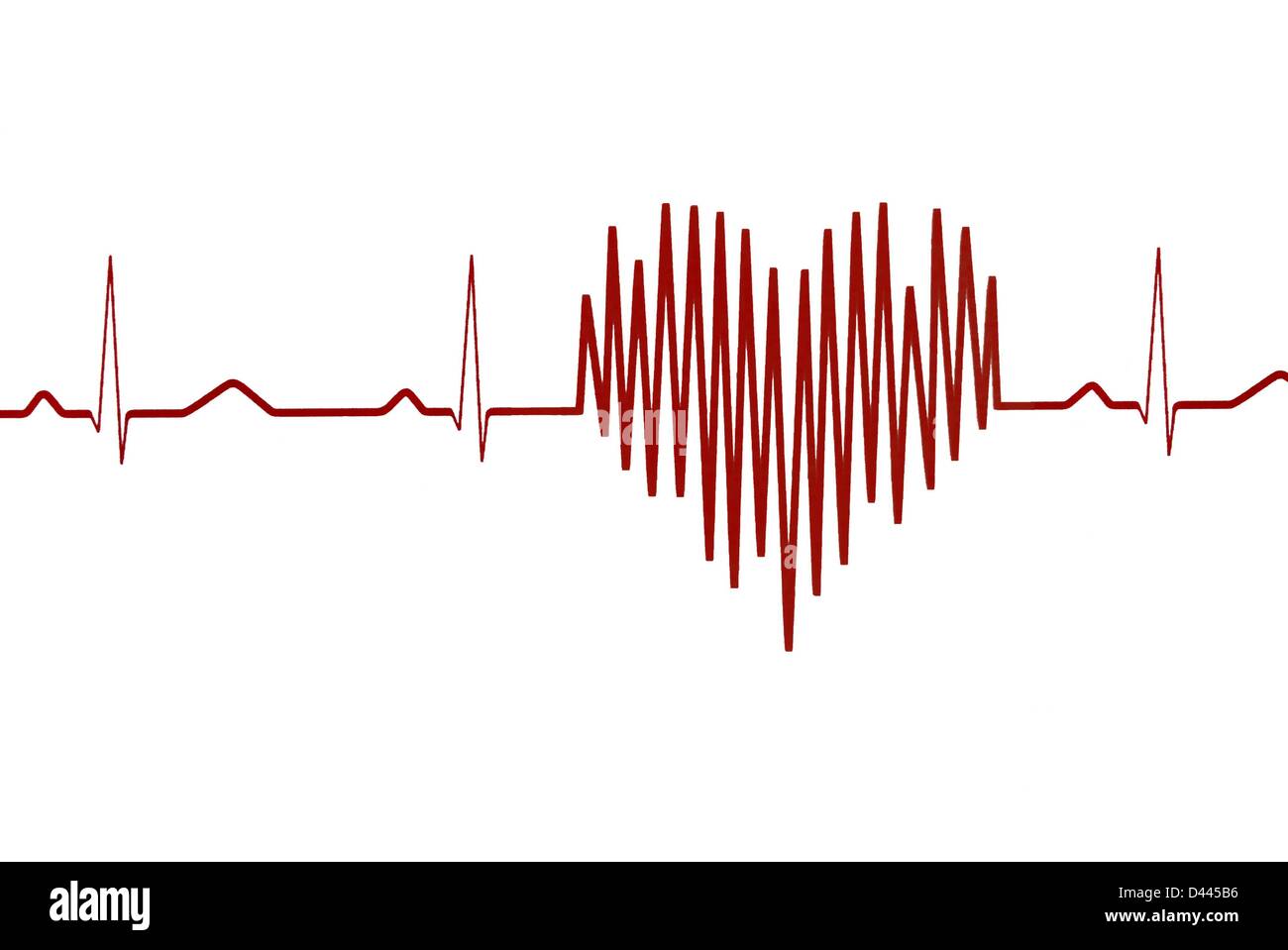 Courbe de fréquence cardiaque Banque de photographies et d’images à ...