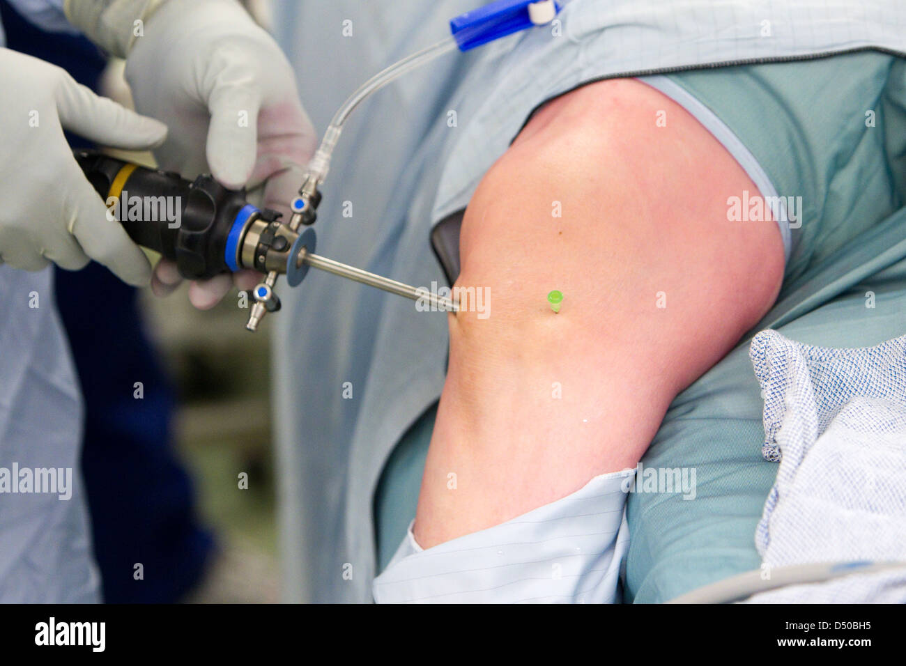 Chirurgie Du Genou Banque d'image et photos - Alamy