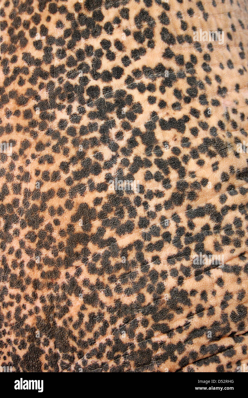 Pigmentation de la peau Banque de photographies et d’images à haute ...