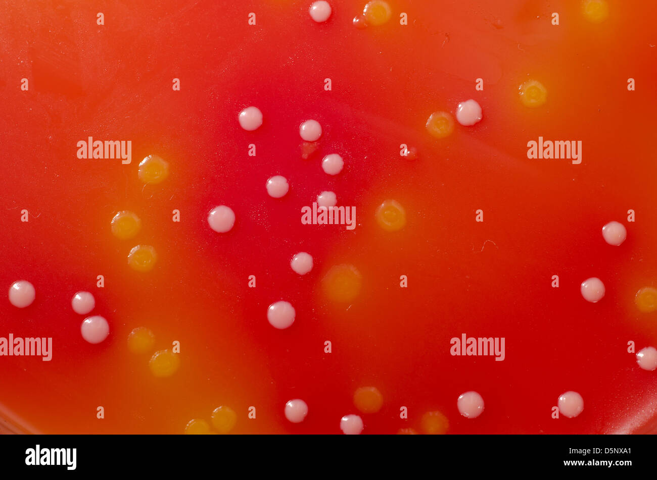 Listeria monocytogenes Banque de photographies et d’images à haute ...