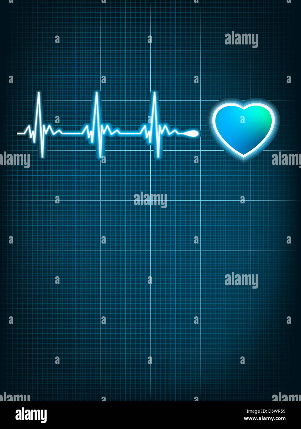 Diagrama de ekg Banque de photographies et d’images à haute résolution ...