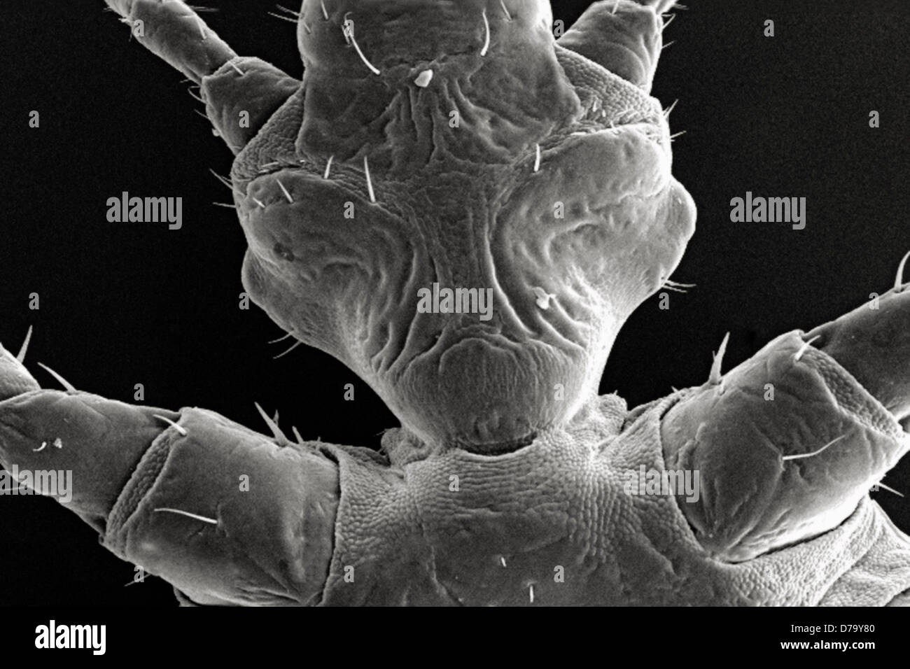 Détail microscopique de l'Exosquelette du pou de corps femelle Surface ...