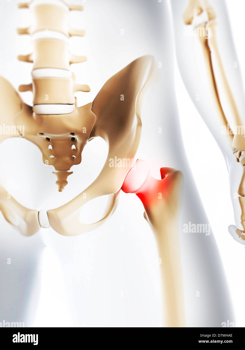Douleurs Articulaires De La Hanche Banque d'image et photos - Page 2 ...