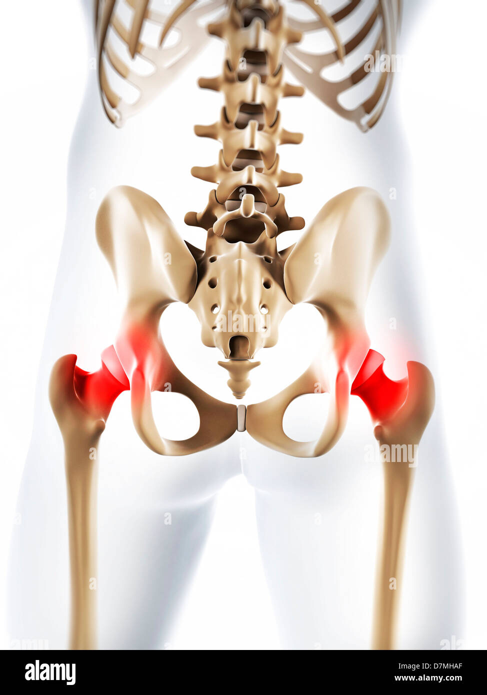 Douleur à la hanche Banque de photographies et d’images à haute ...