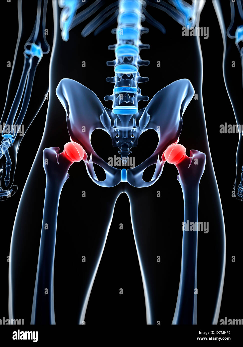 Douleurs Articulaires De La Hanche Banque d'image et photos - Alamy