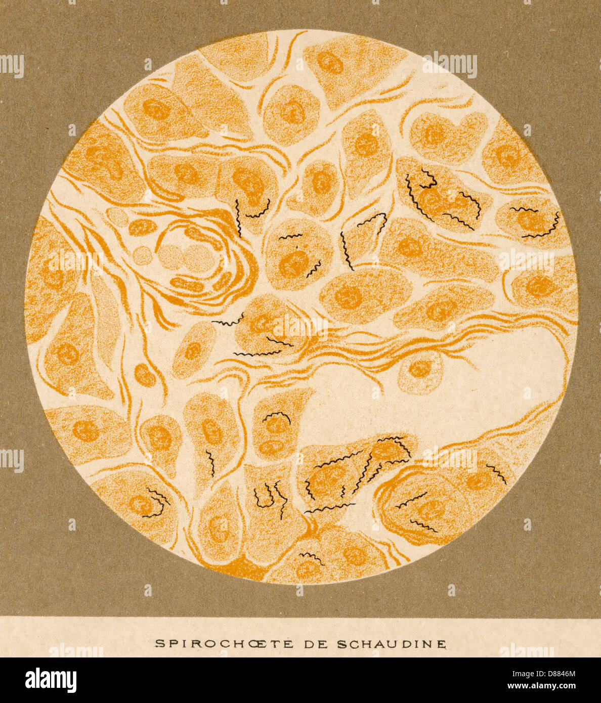 De la syphilis Banque de photographies et d’images à haute résolution ...