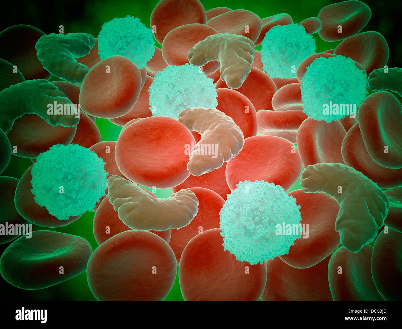 Sickle cells Banque de photographies et d’images à haute résolution - Alamy