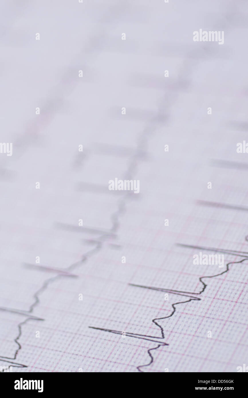 Ekg ou ecg Banque de photographies et d’images à haute résolution - Alamy