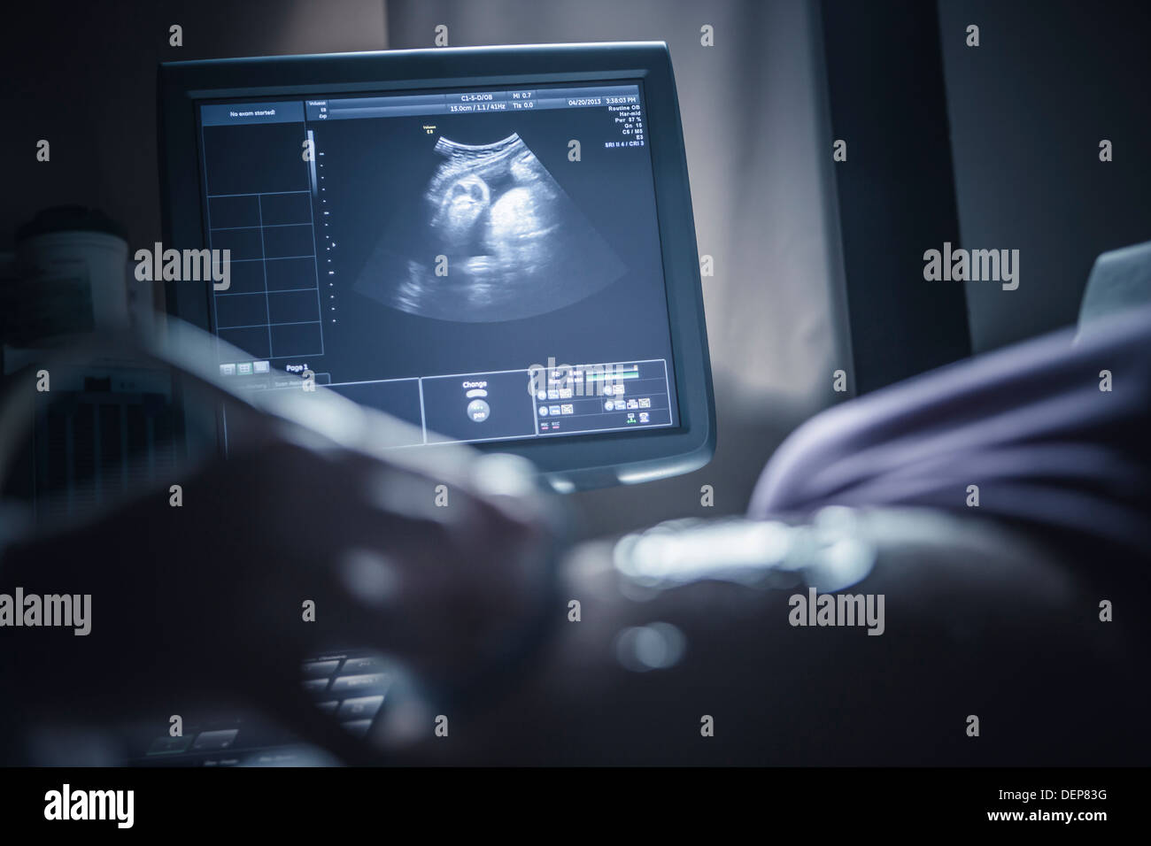 Examen par sonogramme Banque de photographies et d’images à haute ...