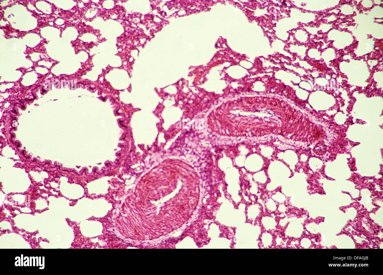 Lung Bronchiole Alveoli Banque d'image et photos - Alamy