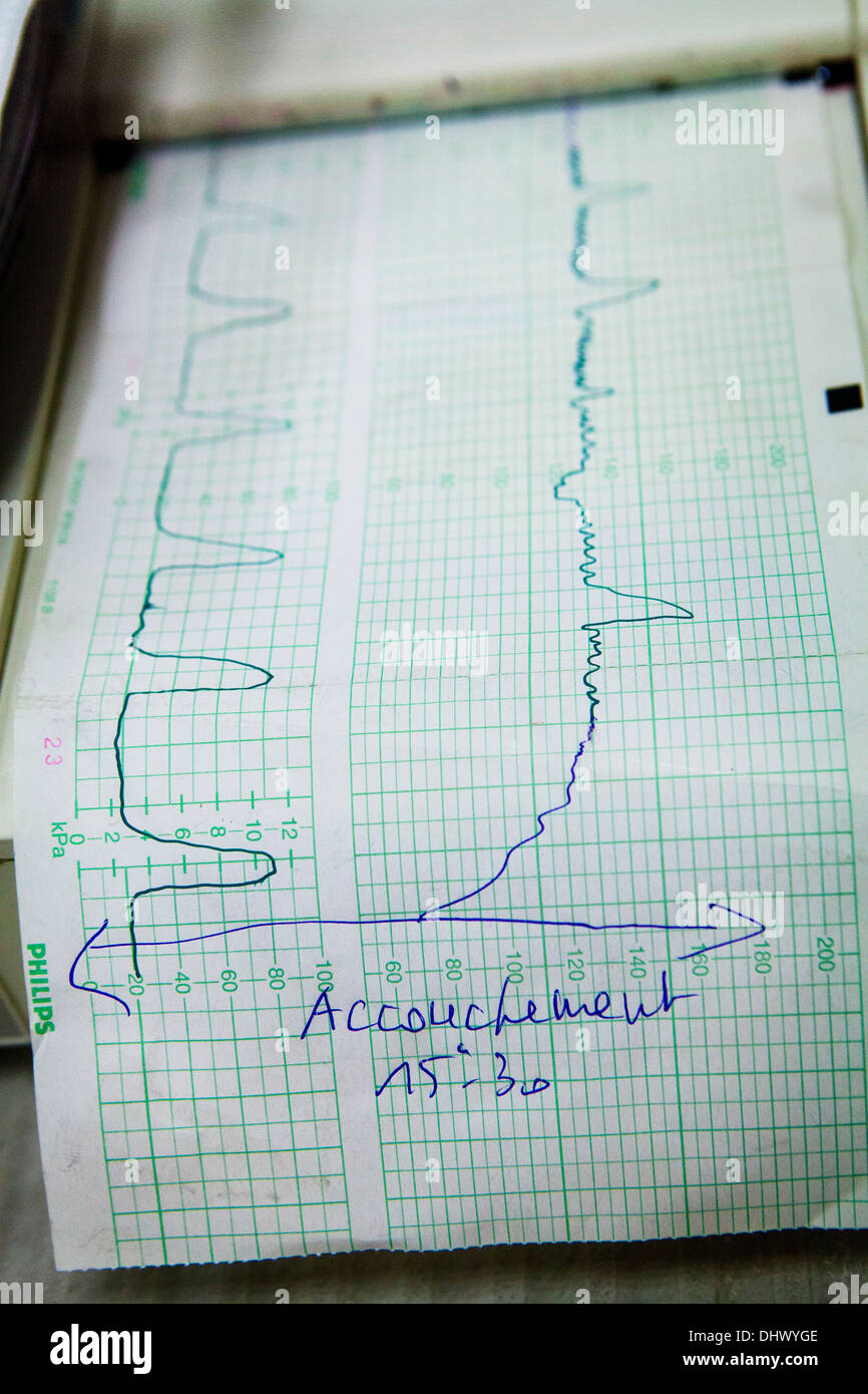 Examen de cardiotocographie Banque de photographies et d’images à haute ...