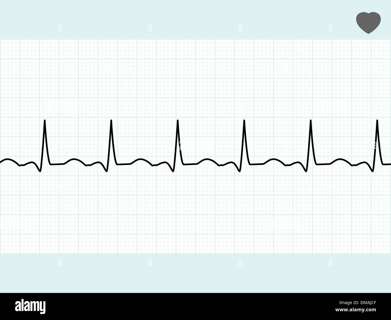 ECG électrocardiogramme normal. EPS 8 Image Vectorielle Stock - Alamy