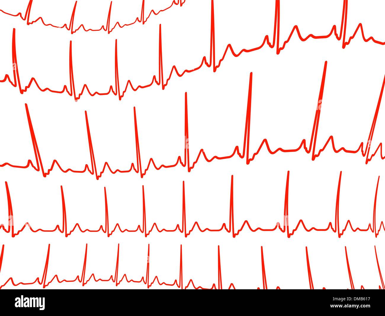 Ecg vectors Banque d'images vectorielles - Alamy