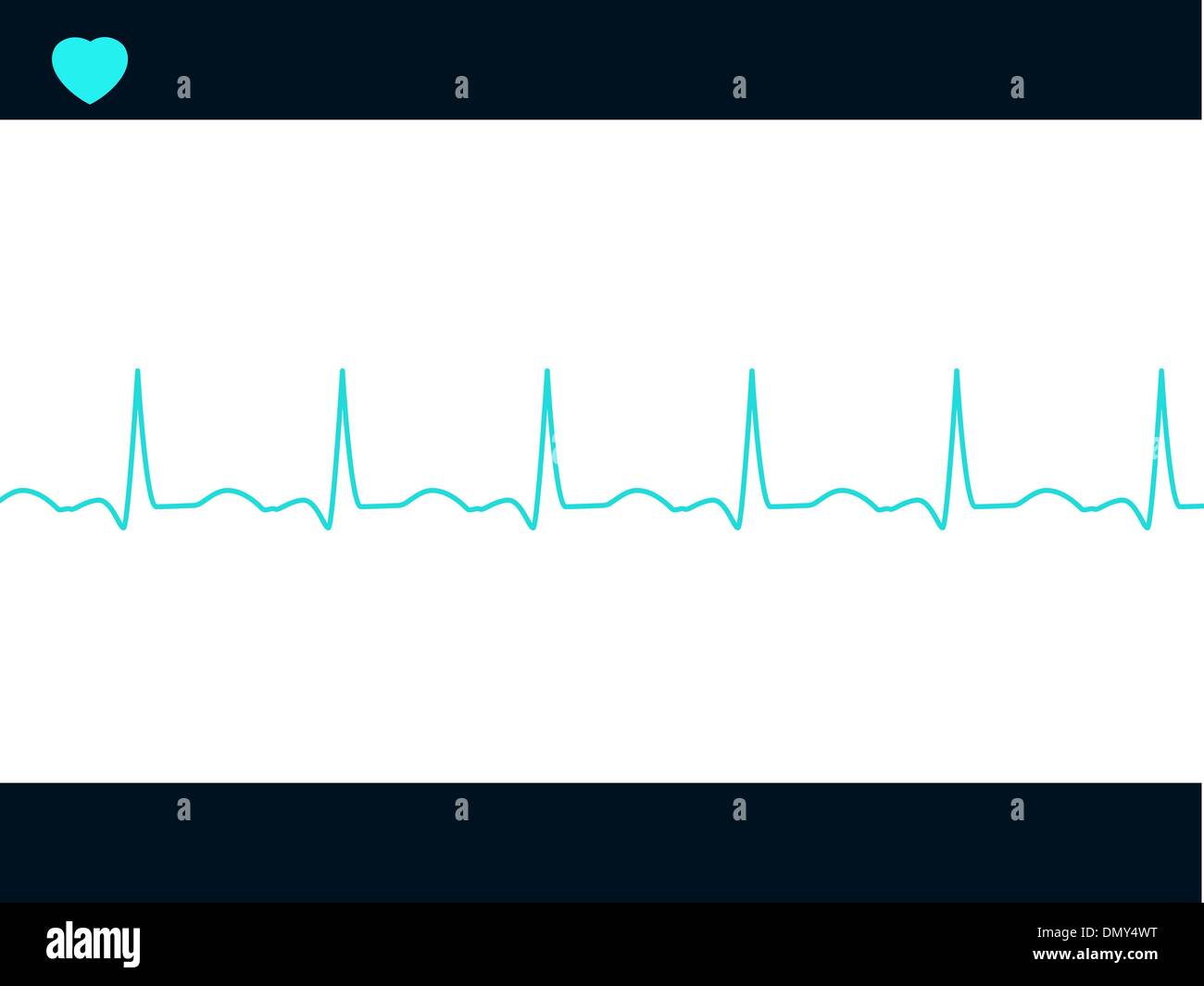 Diagrama de cardiograma Banque d'images vectorielles - Alamy