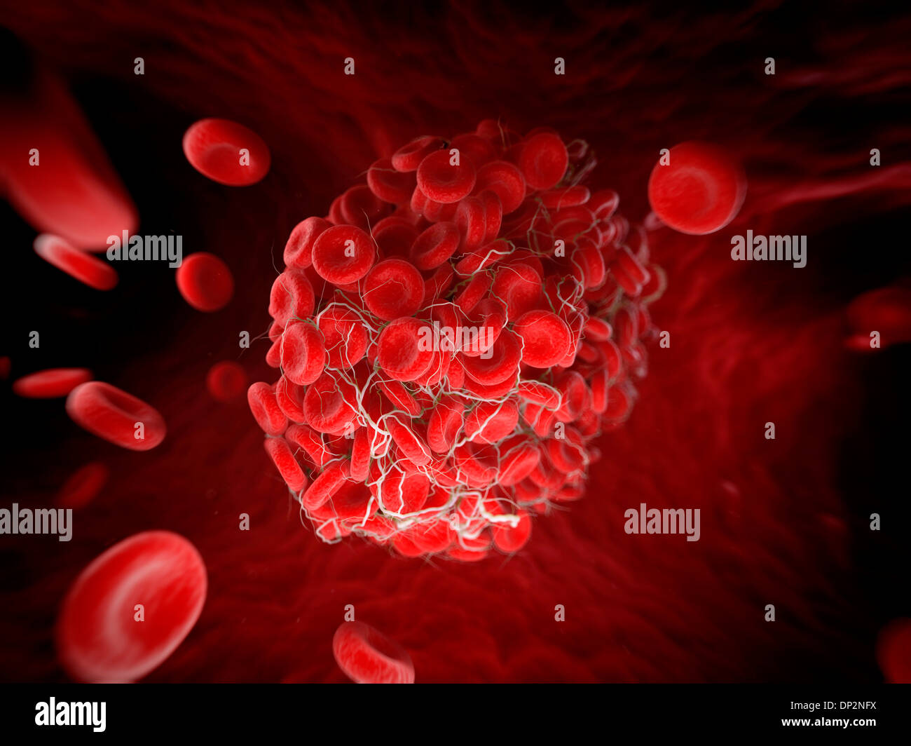 Caillot De Sang Banque d'image et photos - Alamy