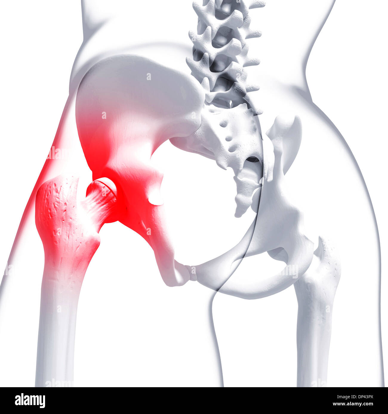 Douleur pelvienne, artwork Photo Stock - Alamy