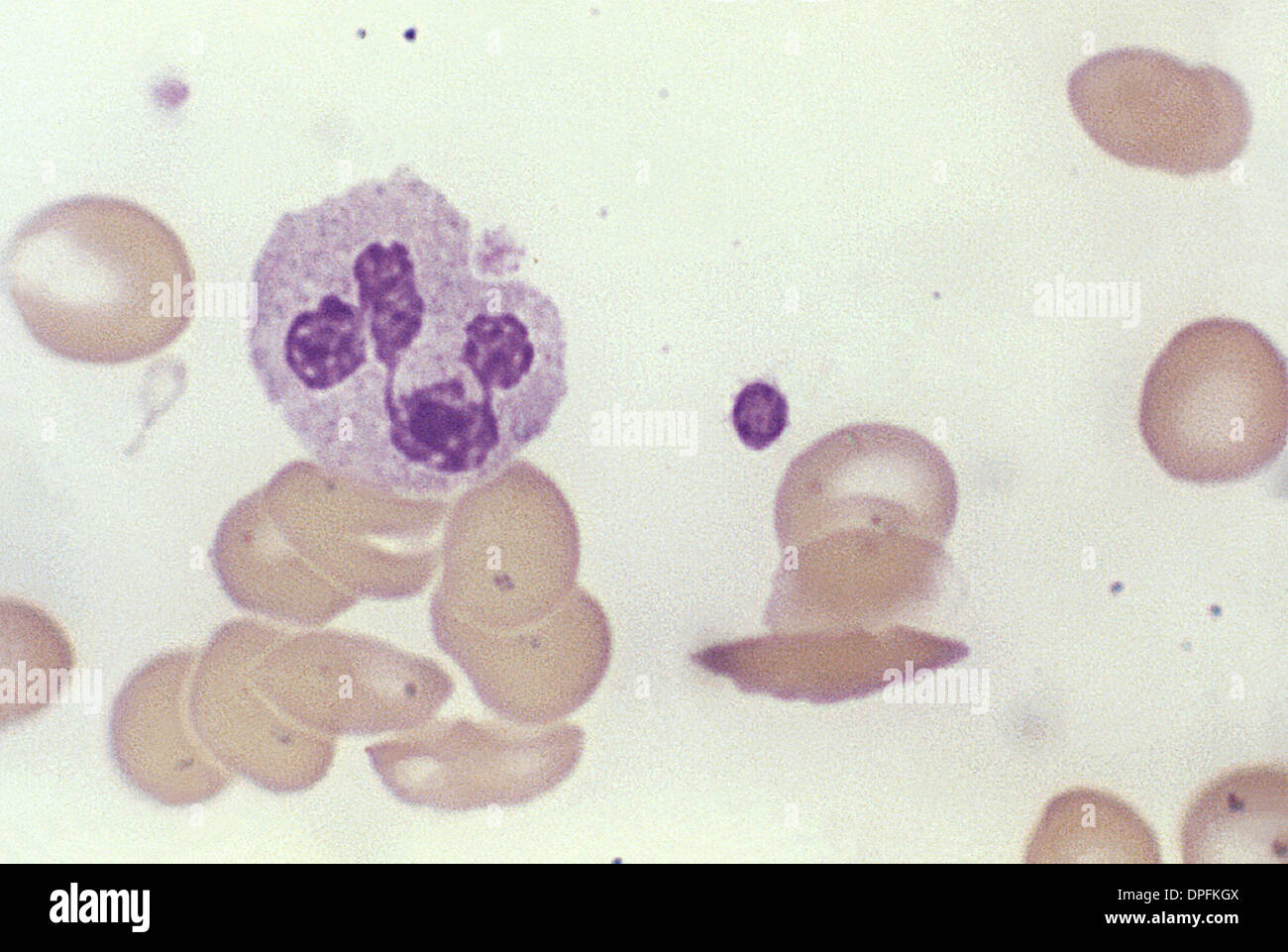 Frottis sanguin normal Banque de photographies et d’images à haute ...