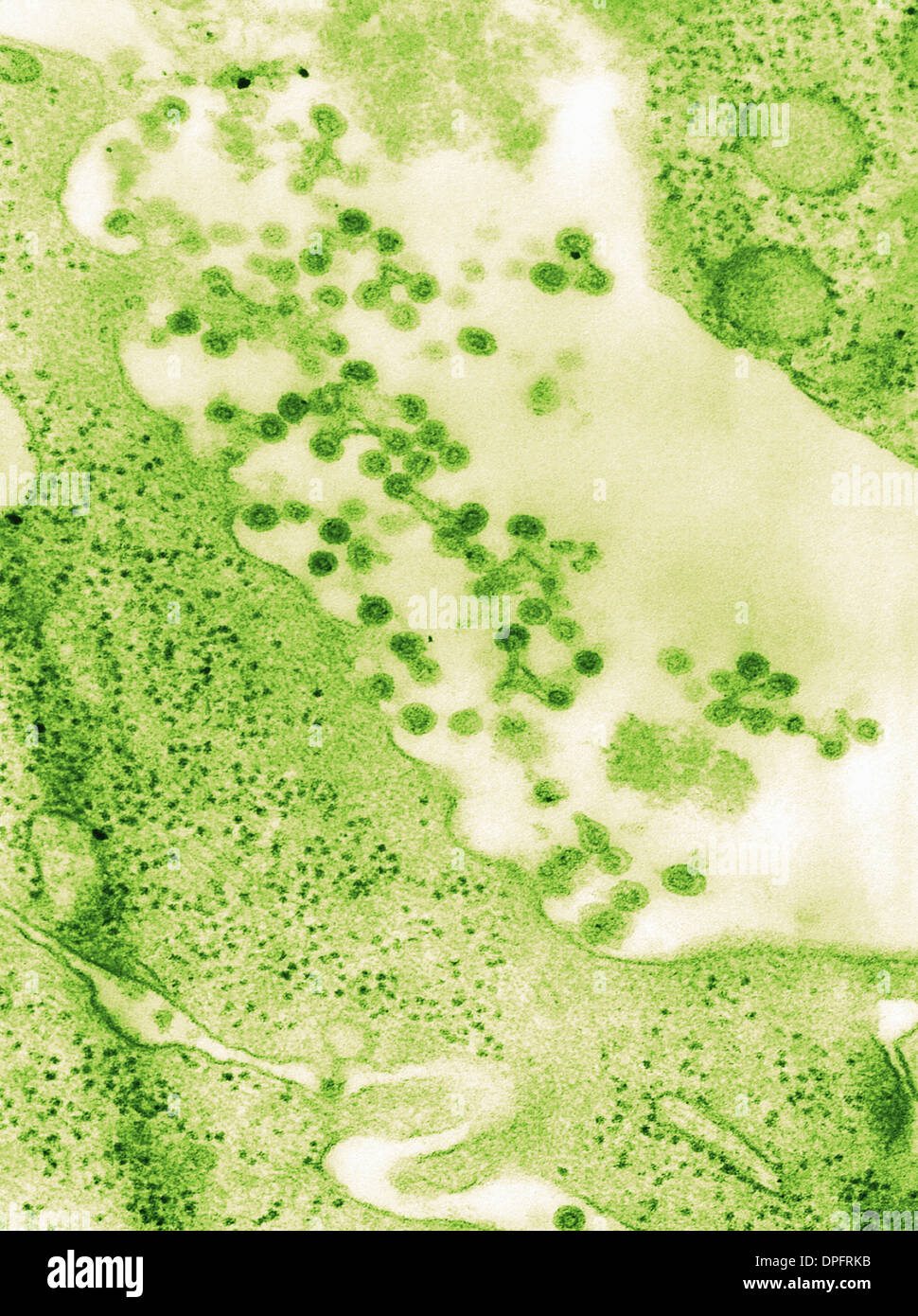 Virus de la rubéole Banque de photographies et d’images à haute ...