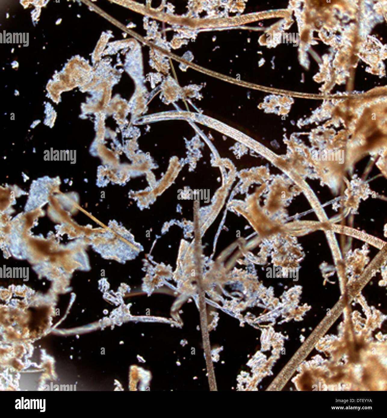Nématode parasite Trichinella spiralis Photo Stock - Alamy