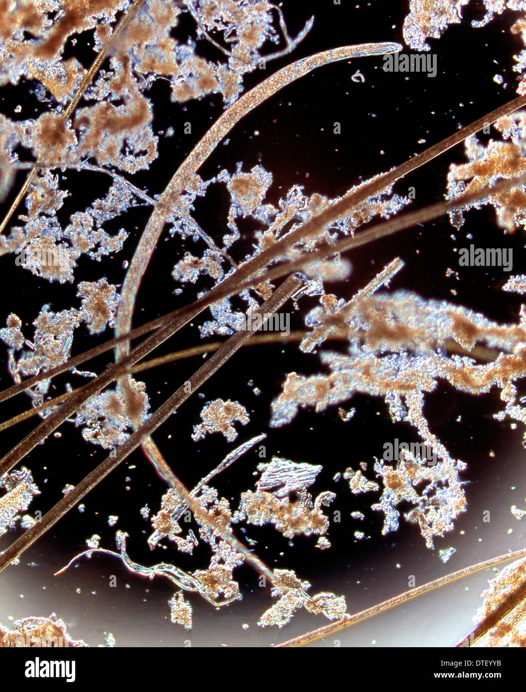 Nématode parasite Trichinella spiralis Photo Stock - Alamy