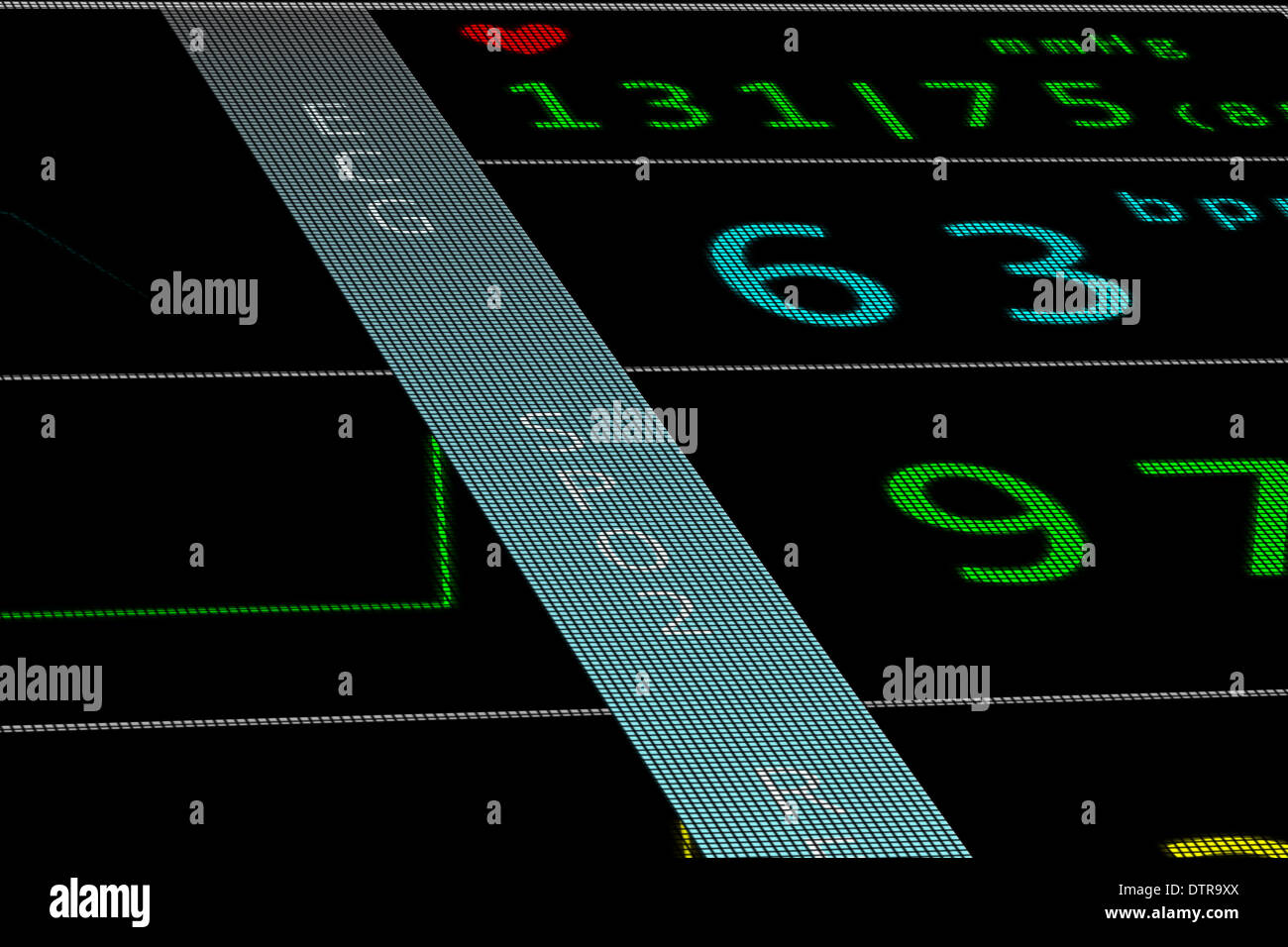 Moniteur cardiaque EKG ECG Illustration Photo Stock - Alamy