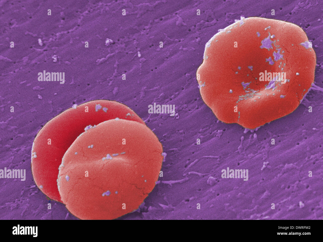 Sickle cell Banque de photographies et d’images à haute résolution - Alamy