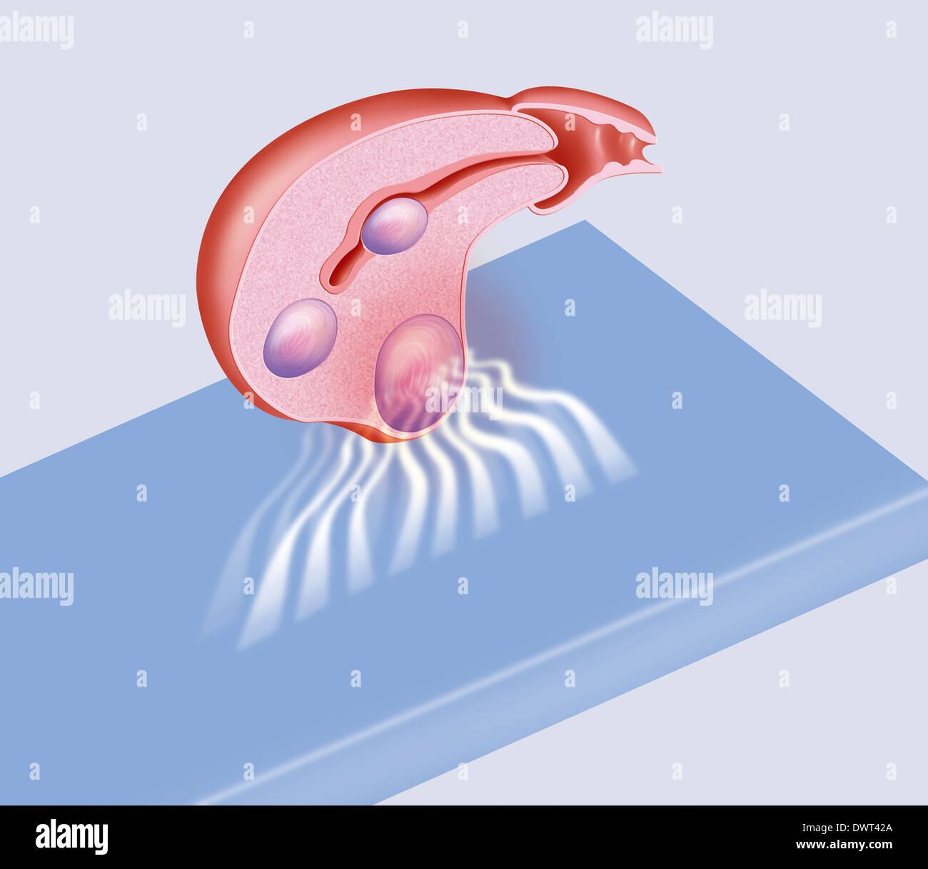 Échographie fibrome utérin Photo Stock - Alamy