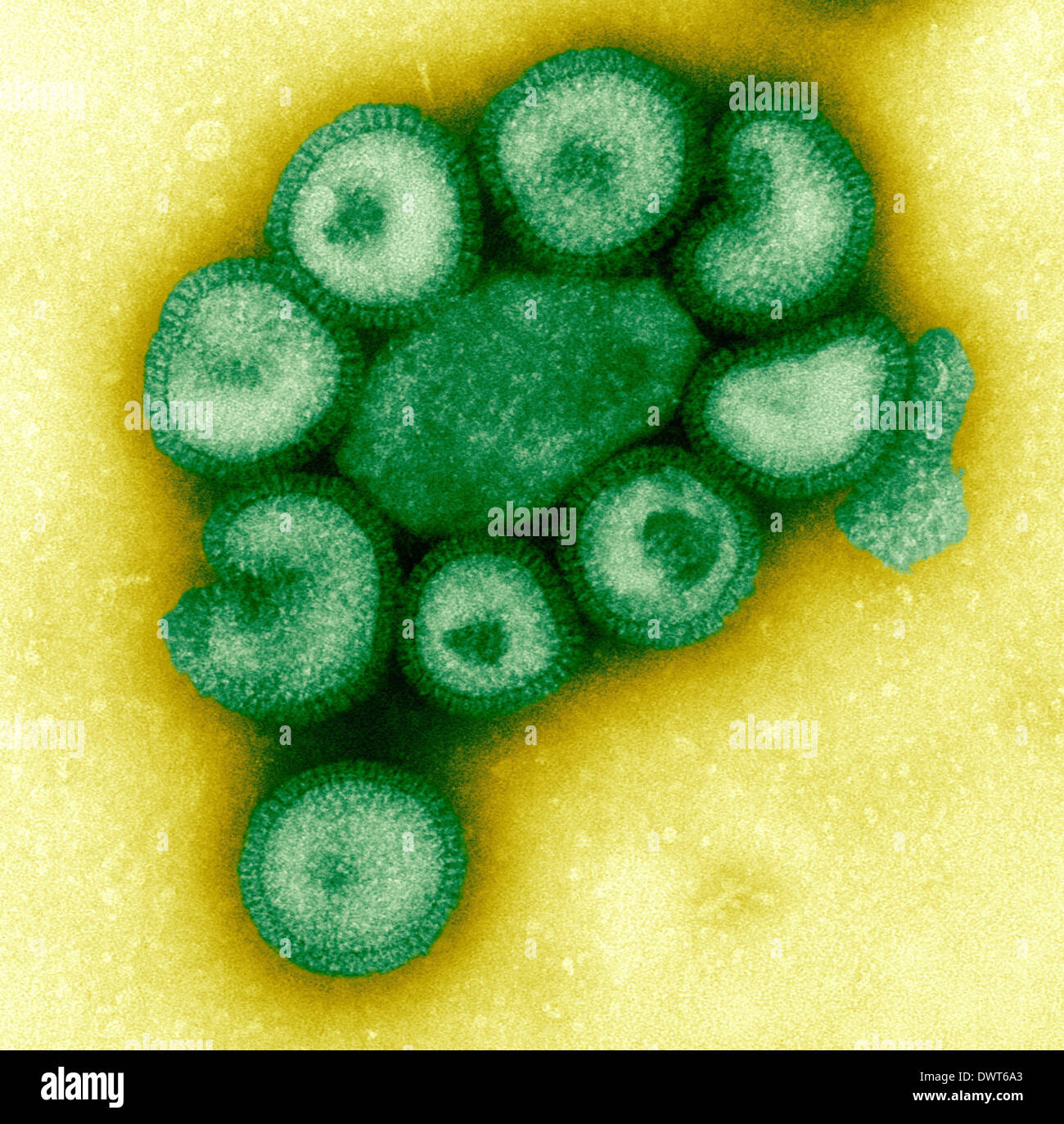 Transmission electron microscopy Banque de photographies et d’images à ...