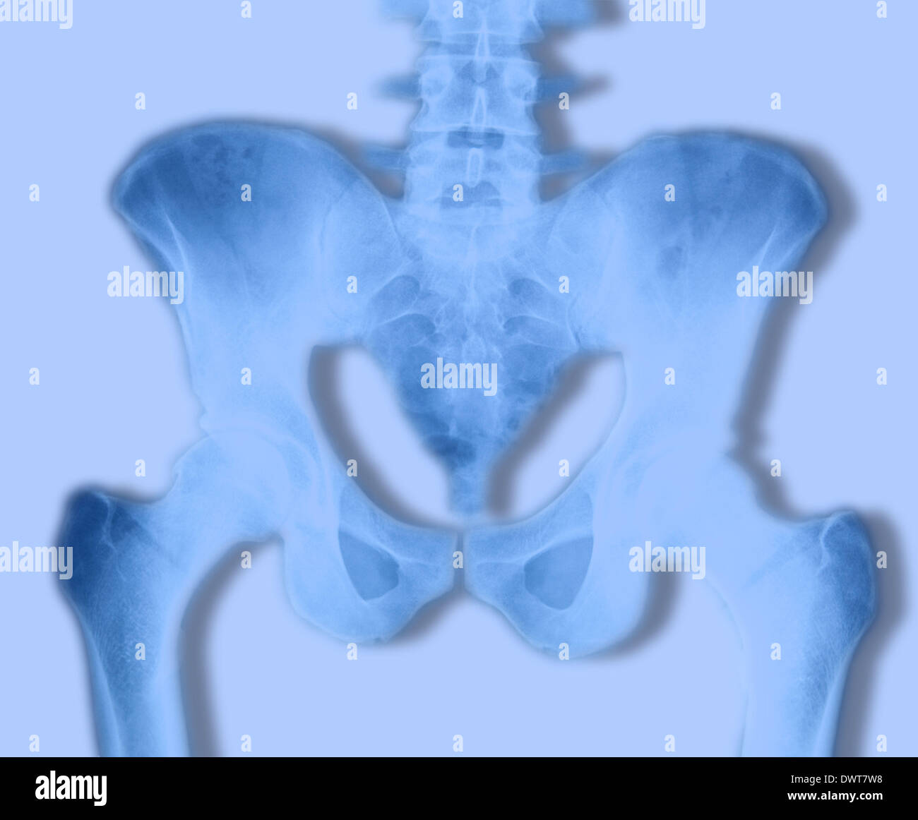 Pubis Homme Banque De Photographies Et Dimages à Haute Résolution Alamy