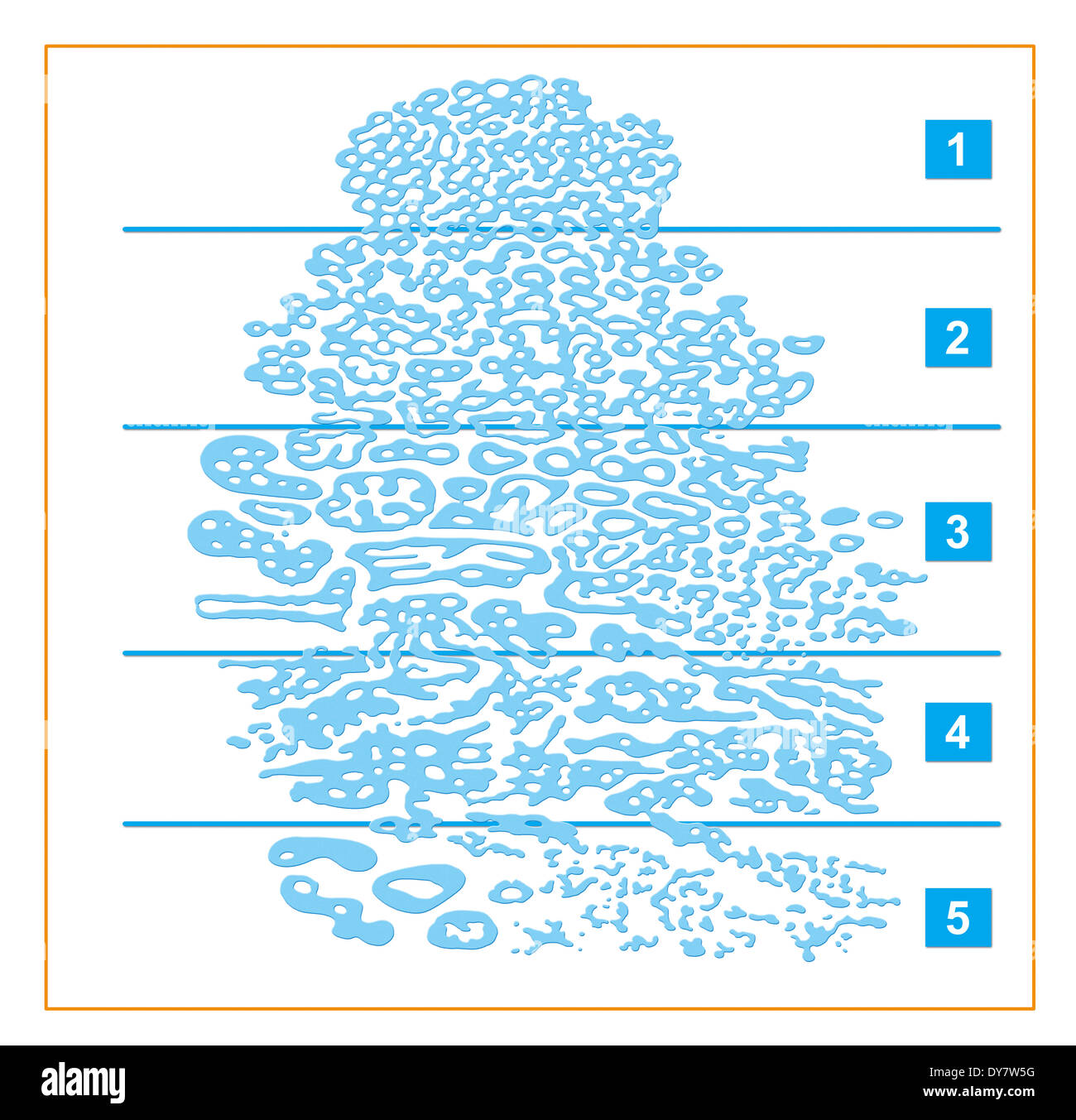 Anatomopathology biopsy Banque de photographies et d’images à haute ...