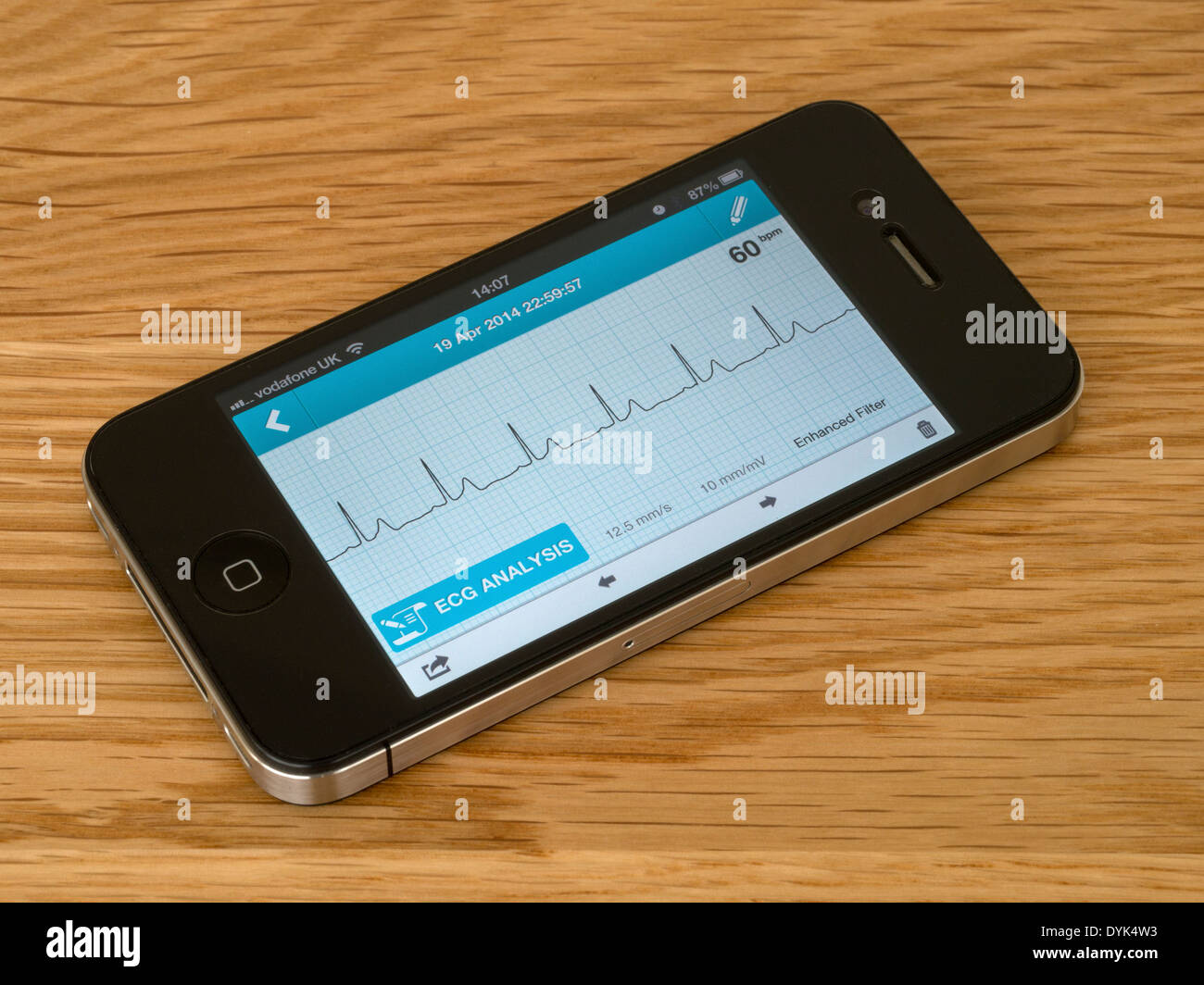 Moniteur cardiaque EKG ECG portable fonctionnant sur l'iPhone 4 App ...