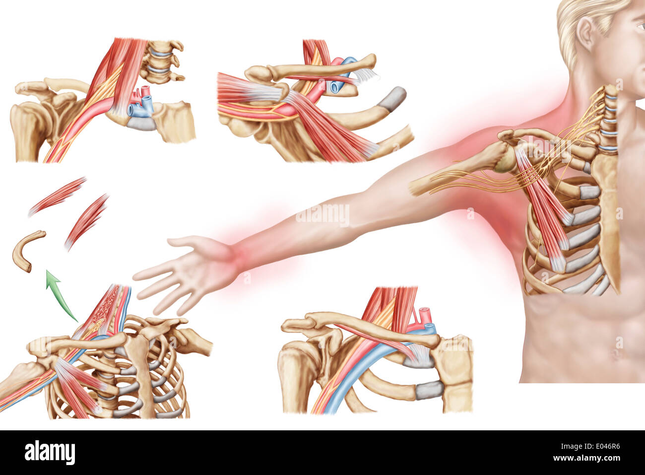 Thoracic Nerves Banque d'image et photos - Alamy