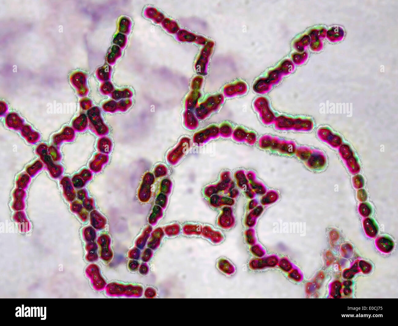 Group a streptococcus Banque de photographies et d’images à haute ...