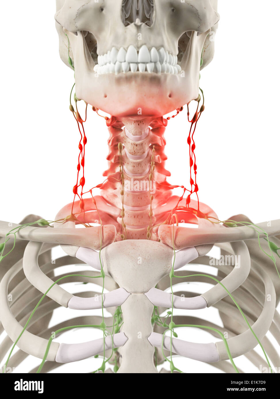 Inflammation des ganglions lymphatiques Banque de photographies et d ...