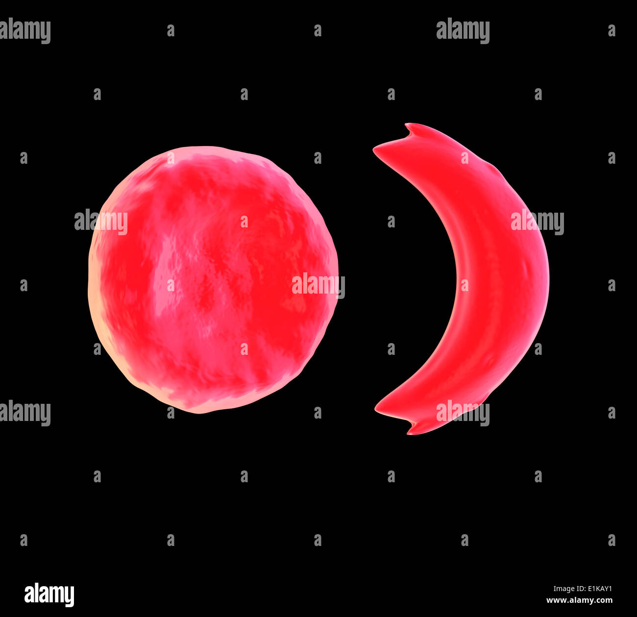 L'anémie falciforme Banque de photographies et d’images à haute ...