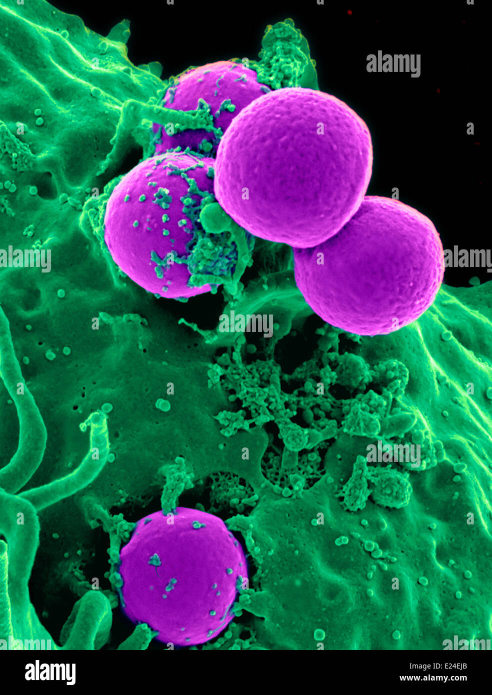 Mrsa microscope Banque de photographies et d’images à haute résolution ...